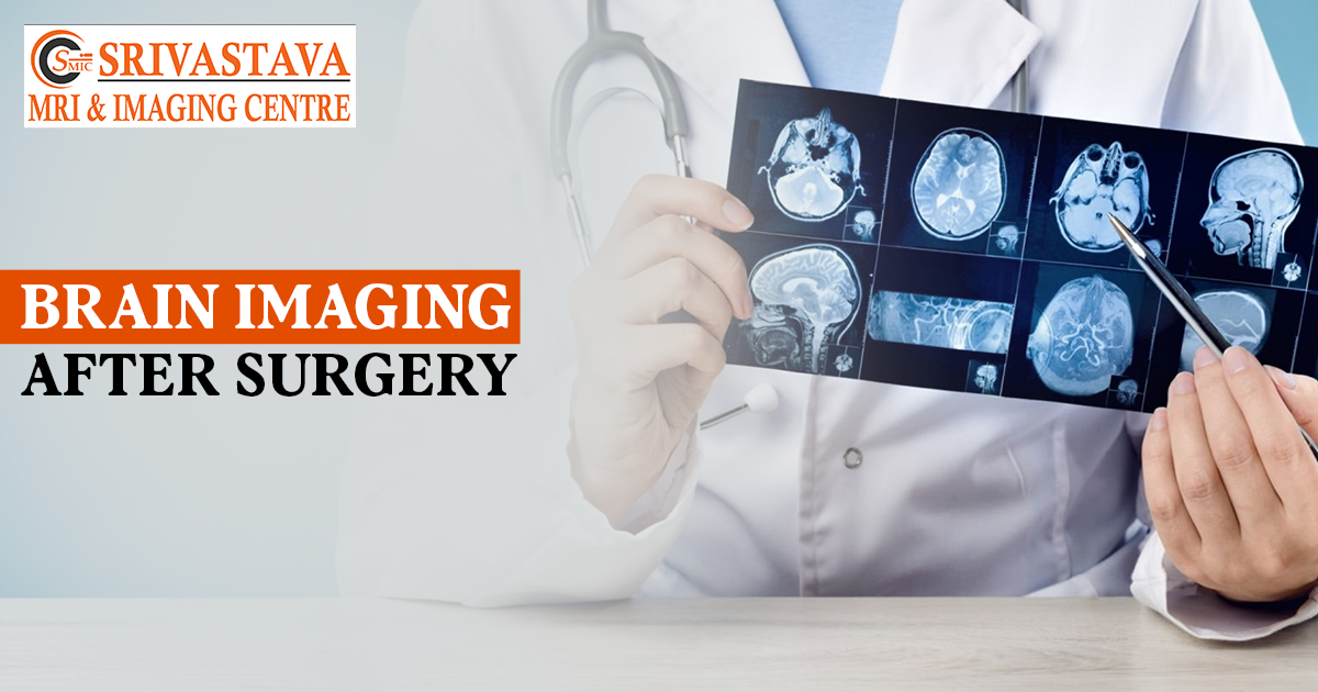 Best MRI Centre in Delhi for Post-Surgery Imaging