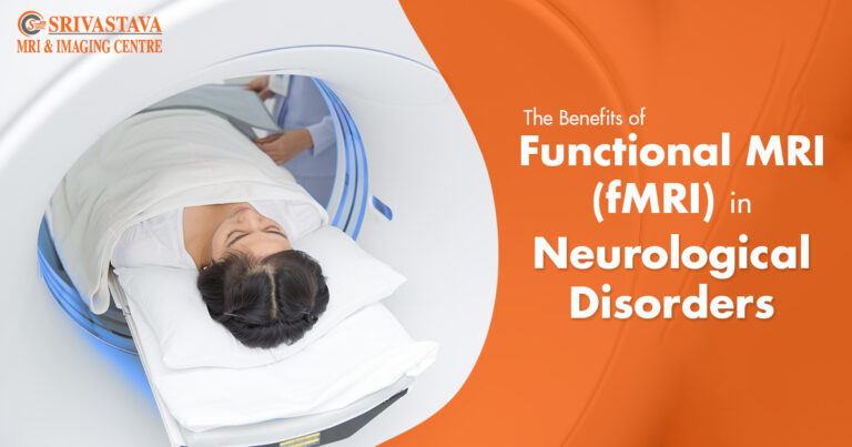 The Benefits of Functional MRI (fMRI) in Neurological Disorders