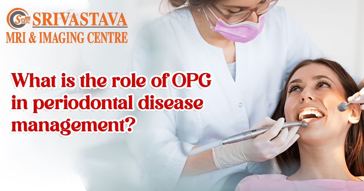 What is the role of OPG in periodontal disease management?