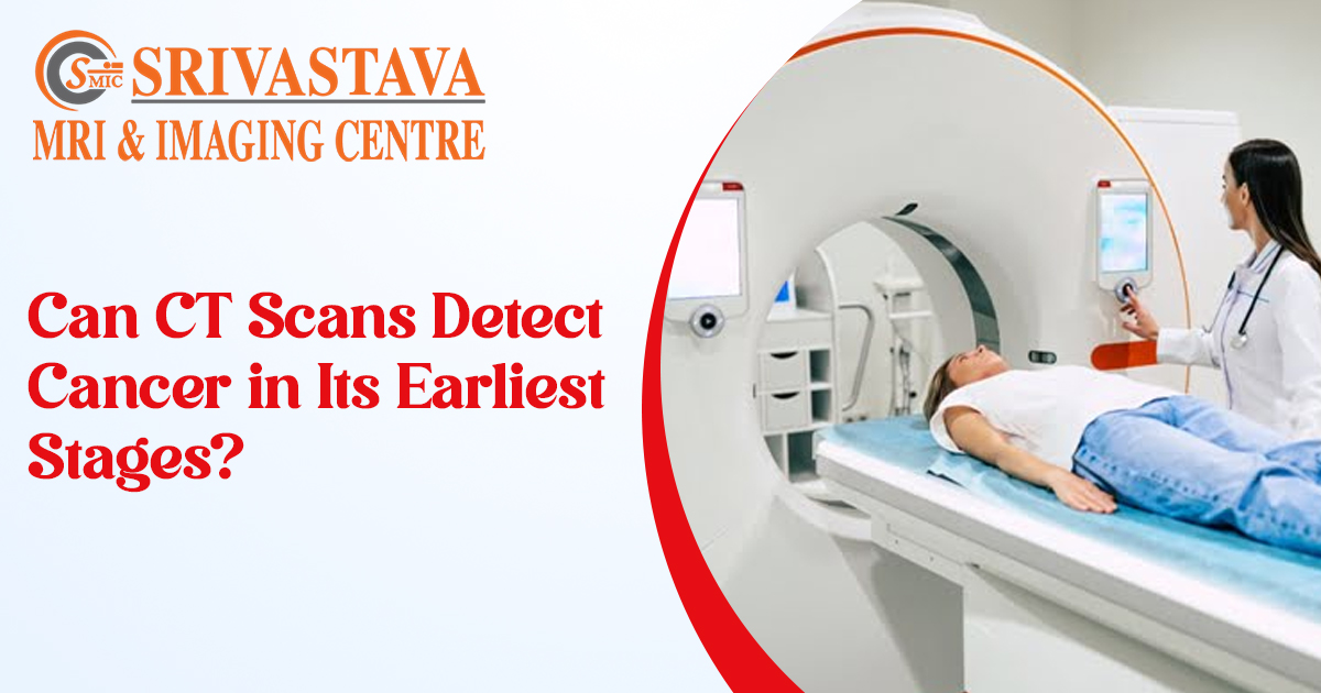 Early Cancer Detection: Can a CT Scan Find It? Learn More